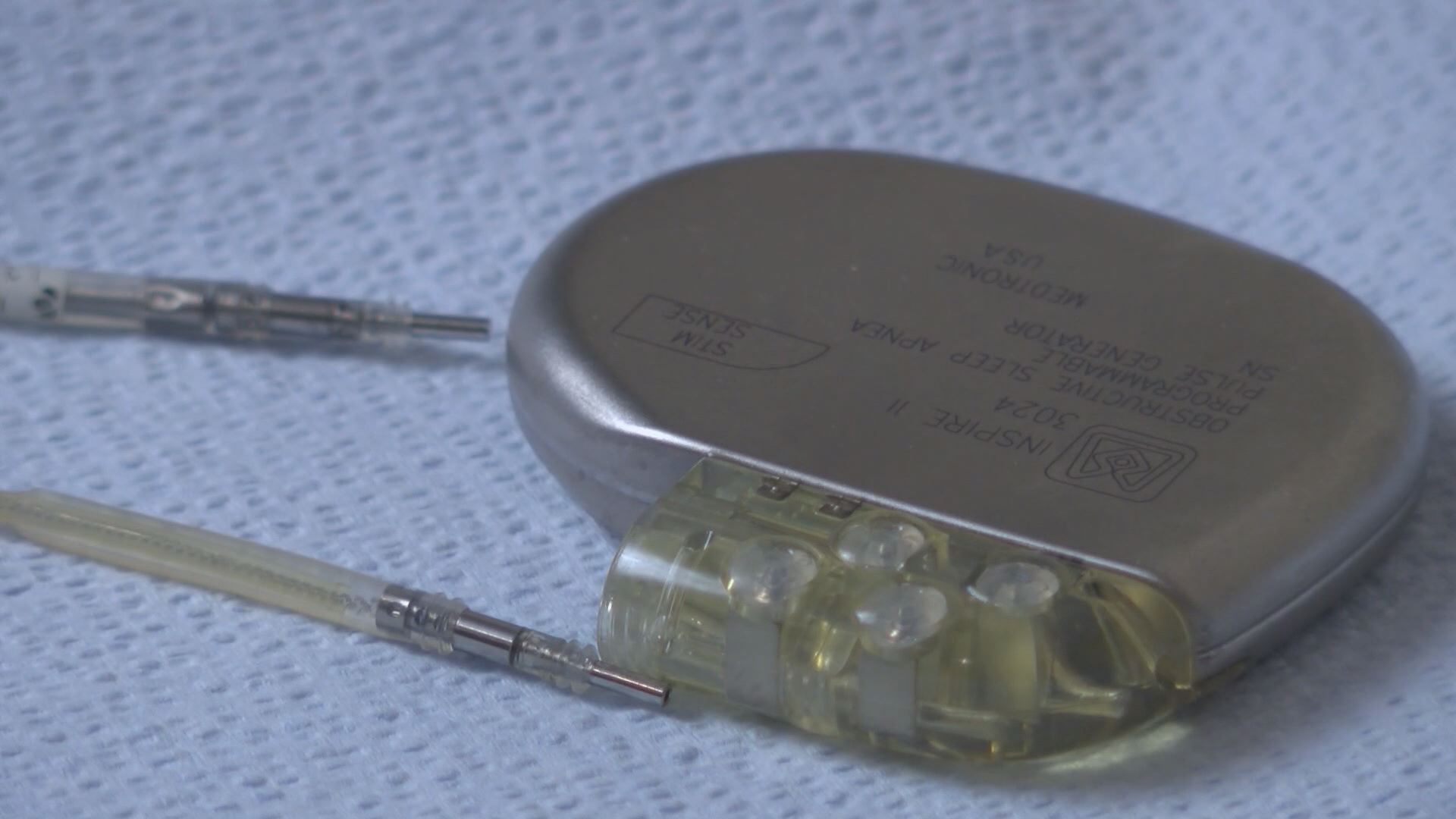 Pacemaker type implant can treat sleep apnea. | wusa9.com